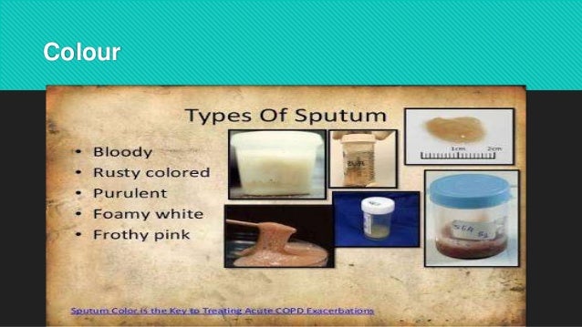 Observation of stools, urine, and sputum