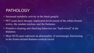 Obsessive compulsive disorder power point (ocd) | PPTX