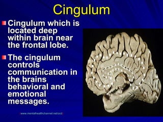 Obsessive Compulsive Disorder | PPT