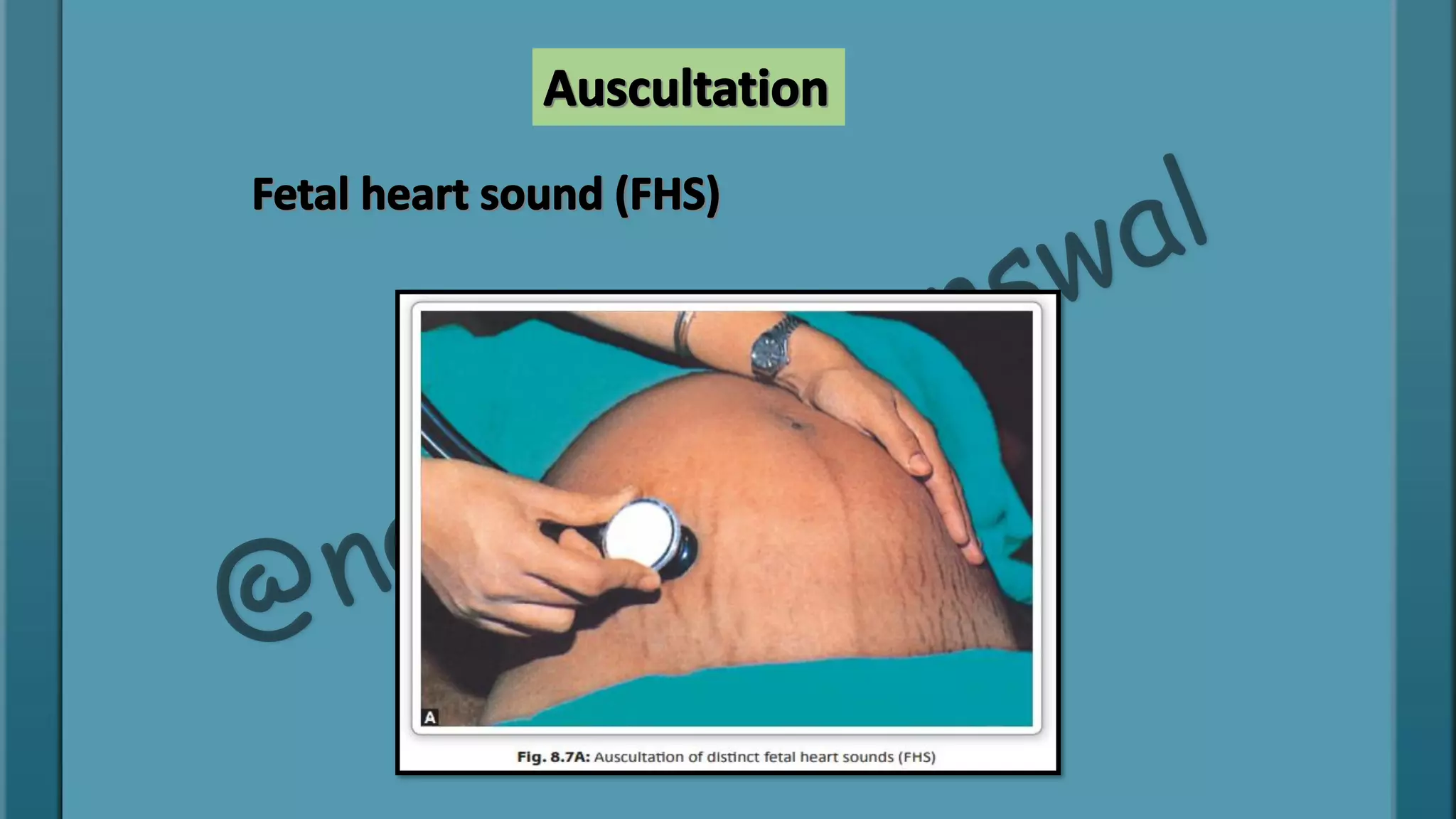 obs examination.pdf@DR.nandana hanswal | PPT