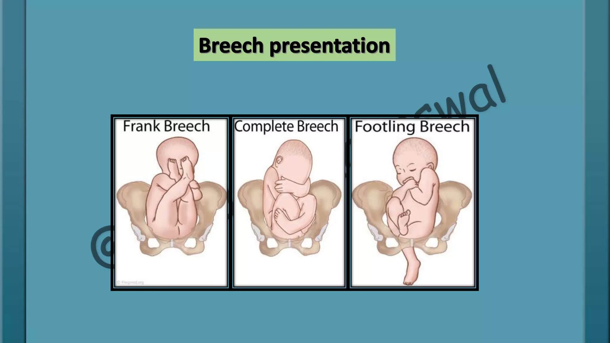 obs examination.pdf@DR.nandana hanswal | PPT