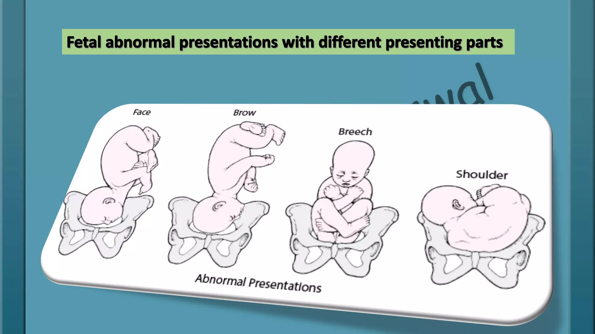 obs examination.pdf@DR.nandana hanswal | PPT