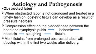 OBS Fistula obstetrics and gynecology ppt | PPTX