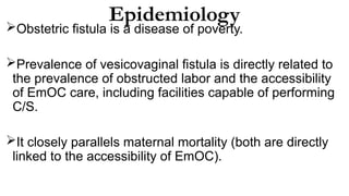 OBS Fistula obstetrics and gynecology ppt | PPTX
