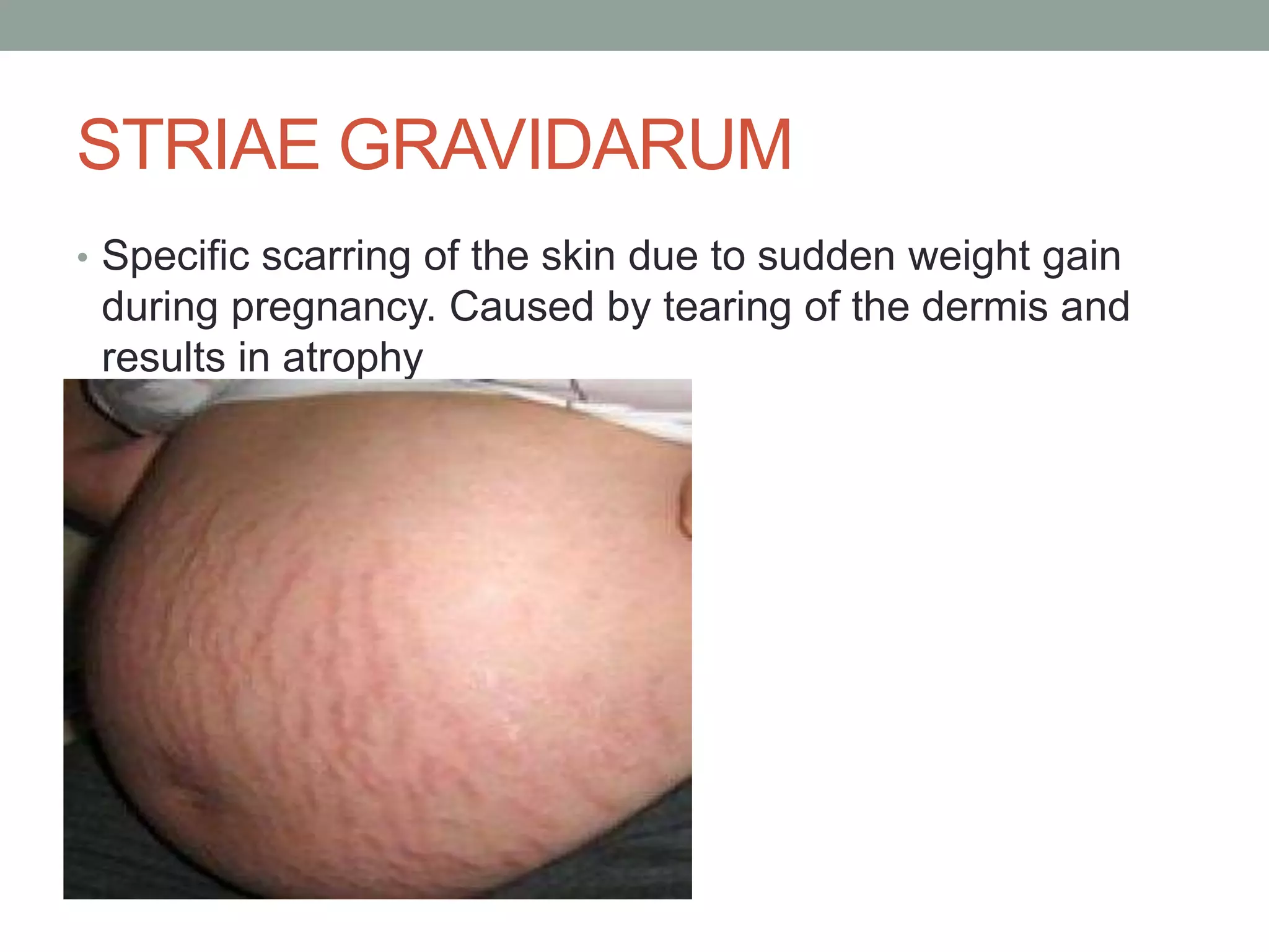 Obstetric History and Examination | PPTX