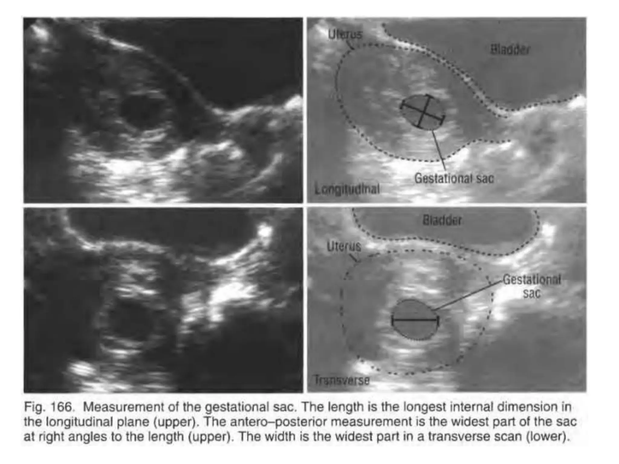 Obstetric and Gynecology Ultrasound Topic | PPT