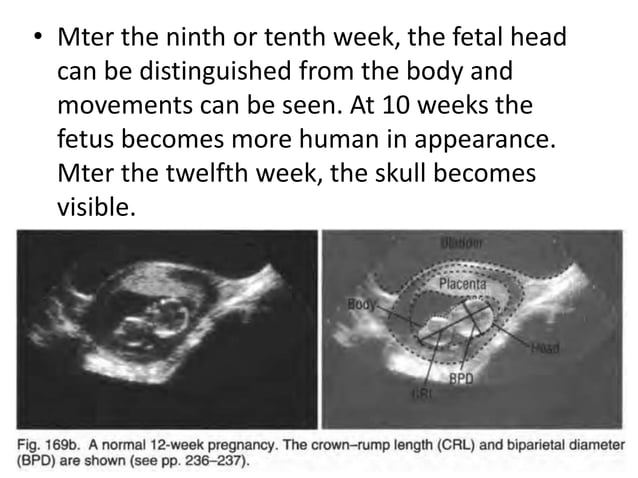 Obstetric and Gynecology Ultrasound Topic | PPT