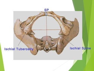 Ischial Spine