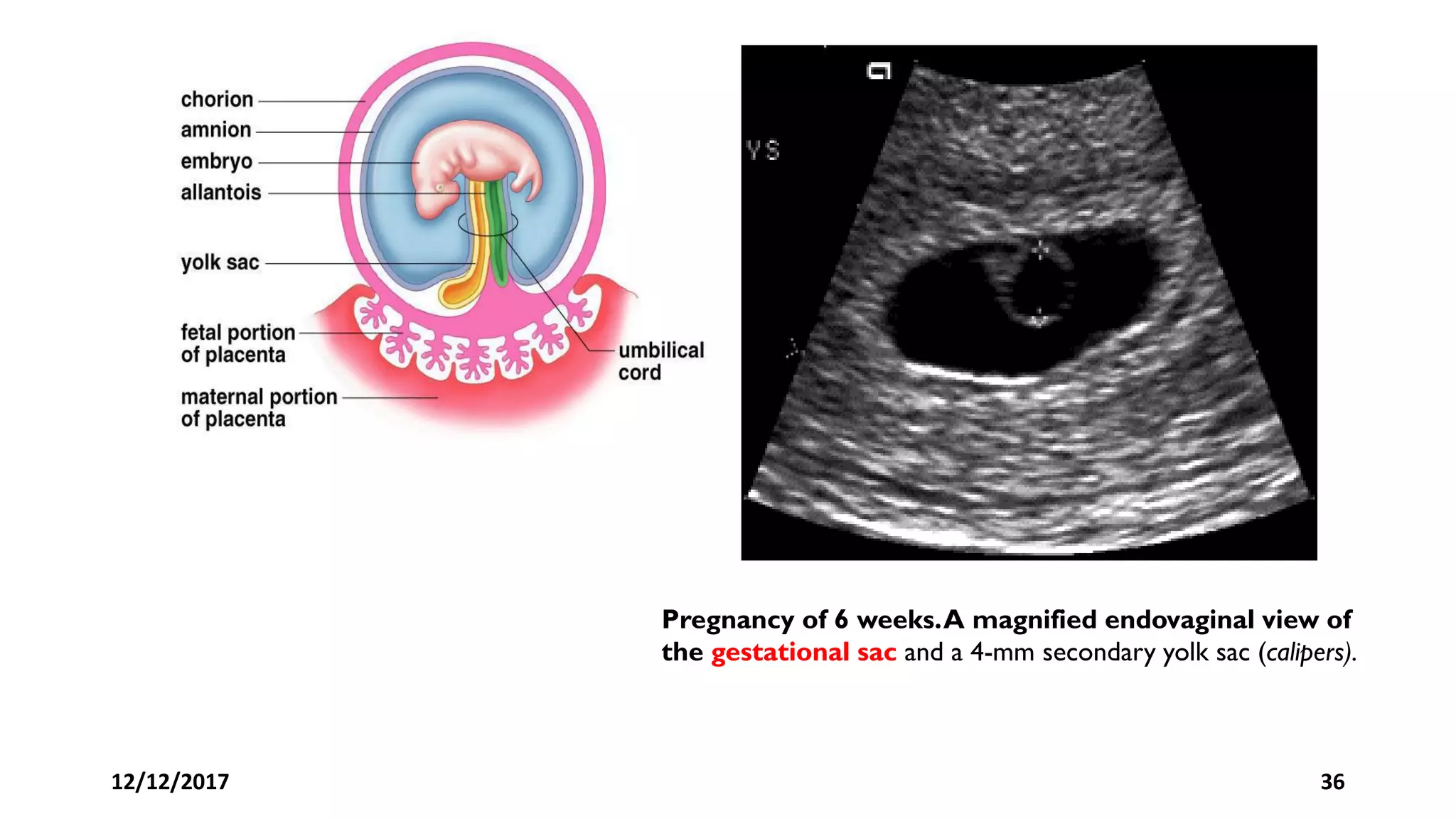 Obstetric ultrasound | PDF