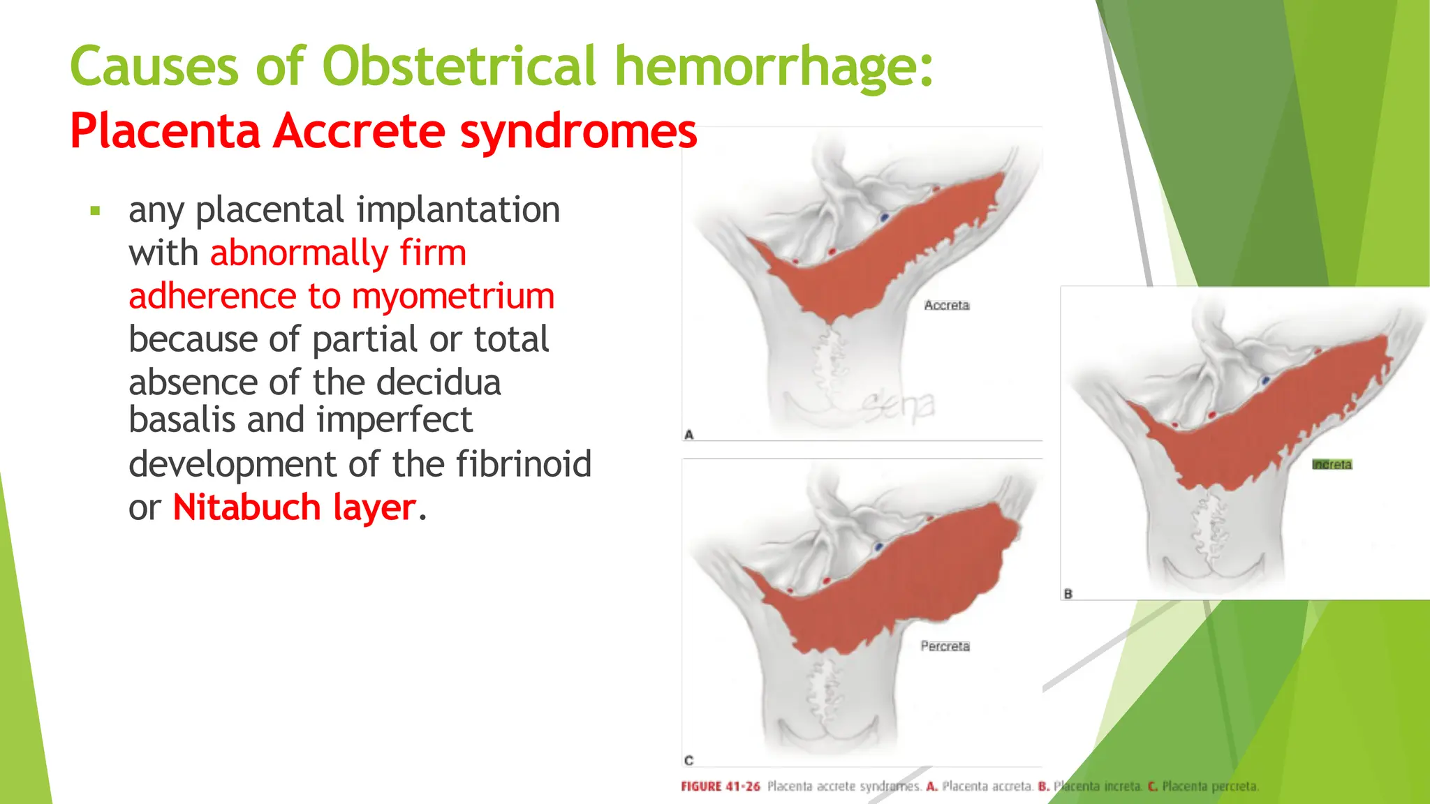 obstetrical-hemorrhage.pdfdownloadfor free | PPT