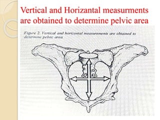 Obstetrical Anatomy of female animal.pptx | Pregnancy | Reproductive Health