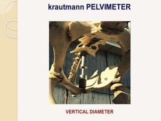 Obstetrical Anatomy of female animal.pptx | Pregnancy | Reproductive Health