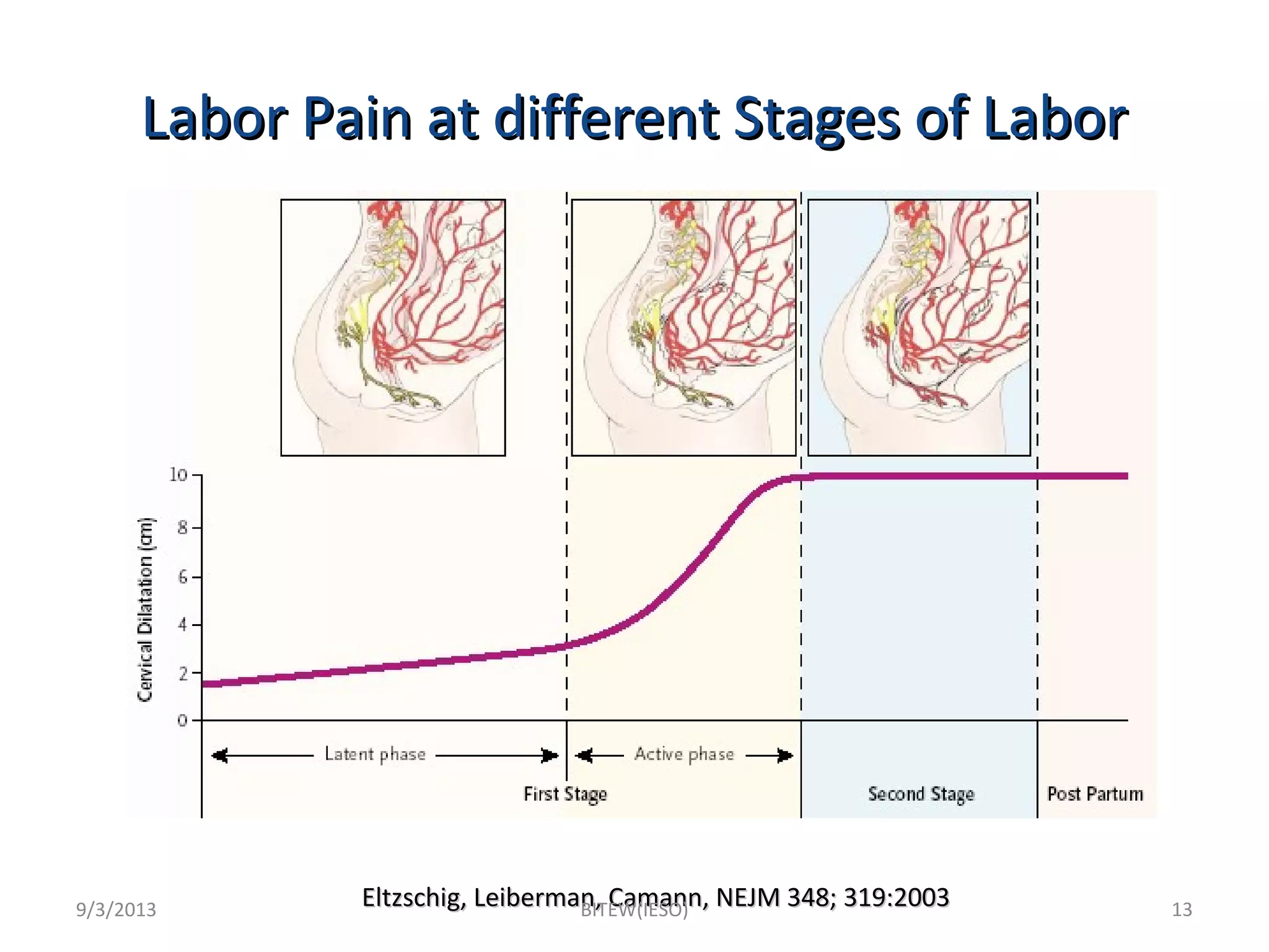 Obstetrical Anesthesia | PPT
