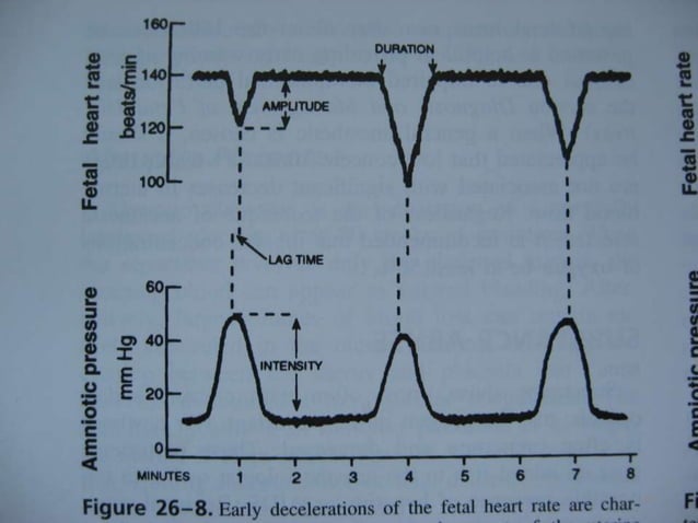 OBSTETRICAL ANESTHESIA.ppt