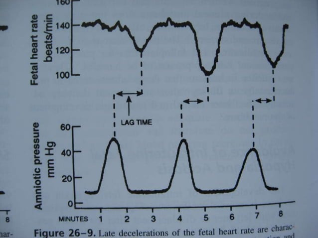 OBSTETRICAL ANESTHESIA.ppt