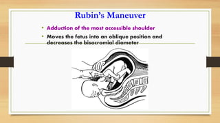 Obstetrical emergencies | PPT