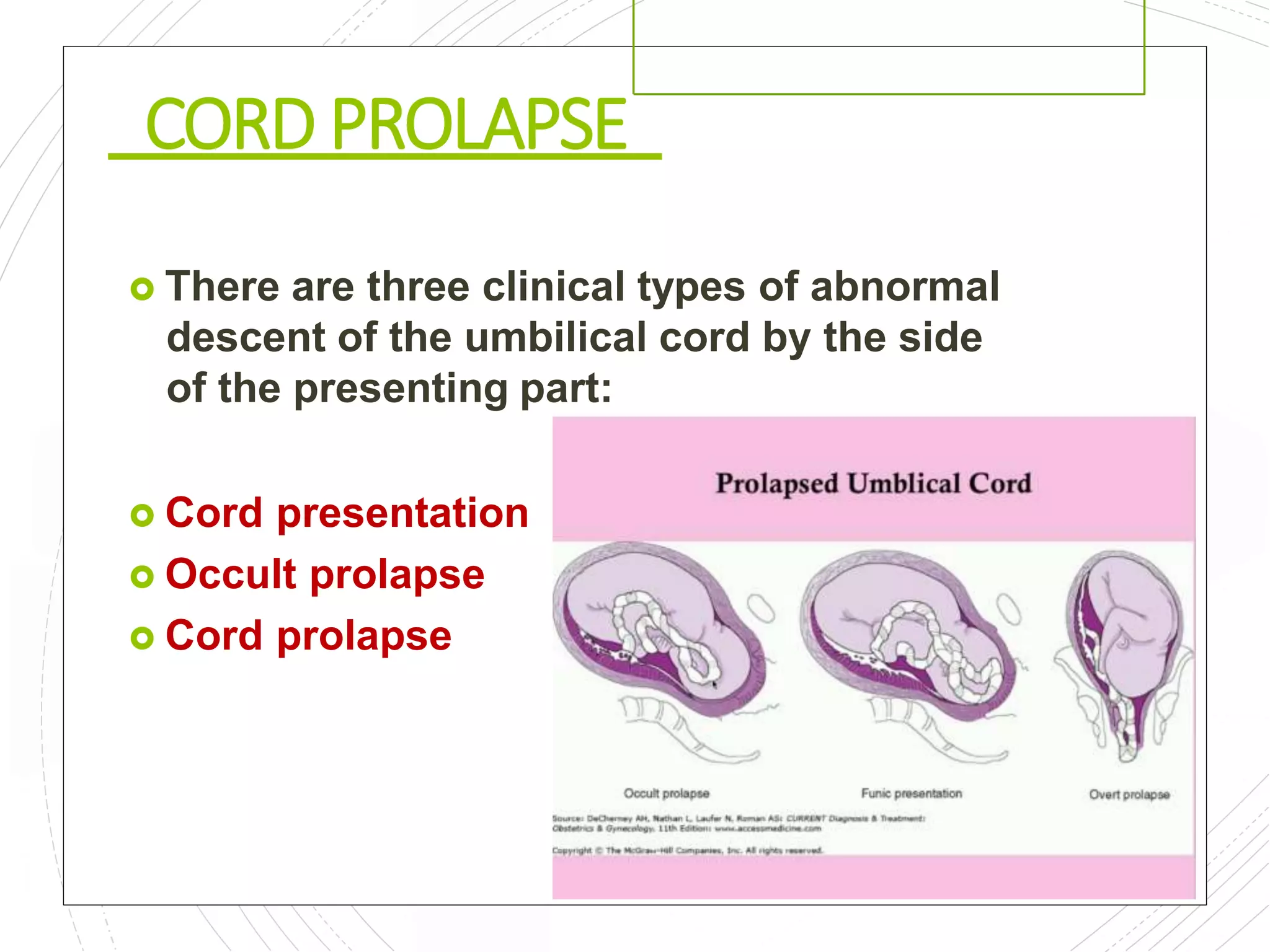Obstetrical emergencies | PPTX
