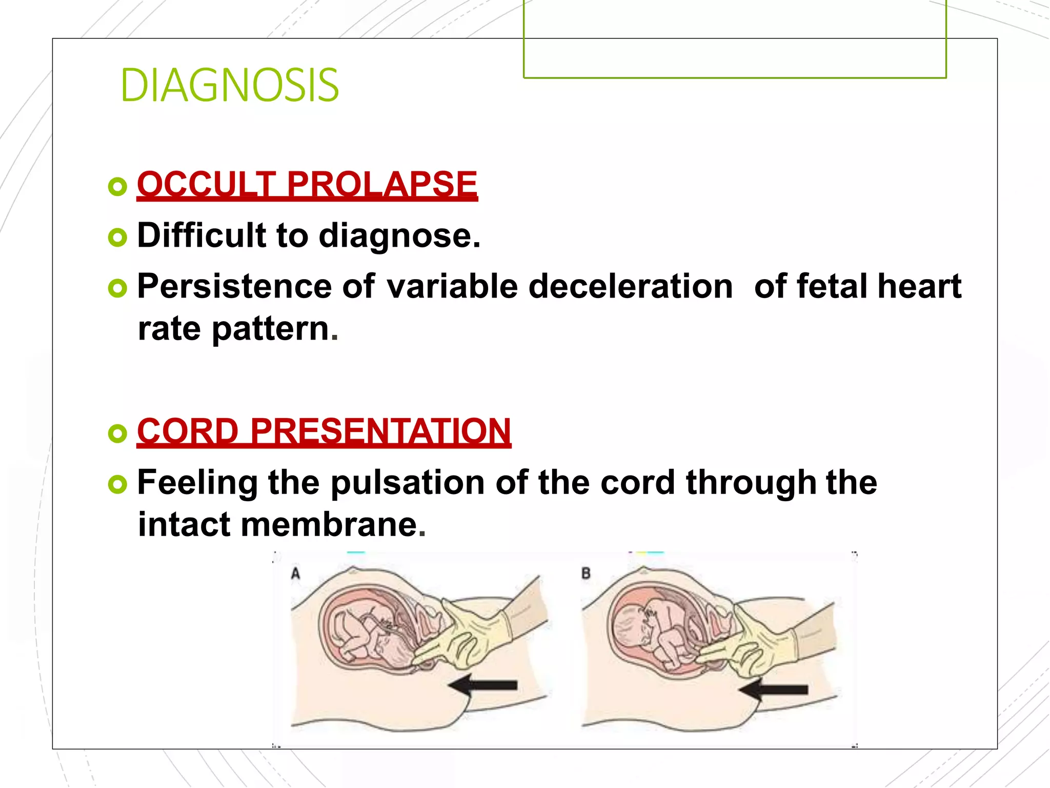 Obstetrical emergencies | PPTX
