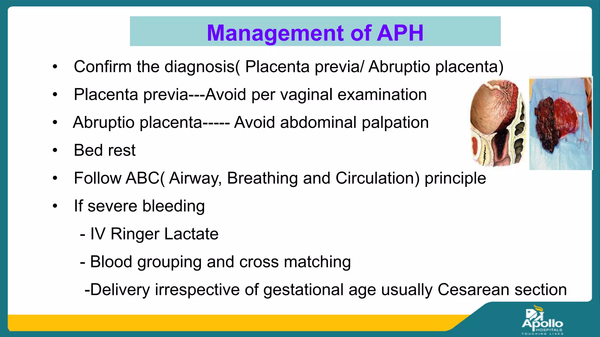Obstetrical emergencies | PPTX