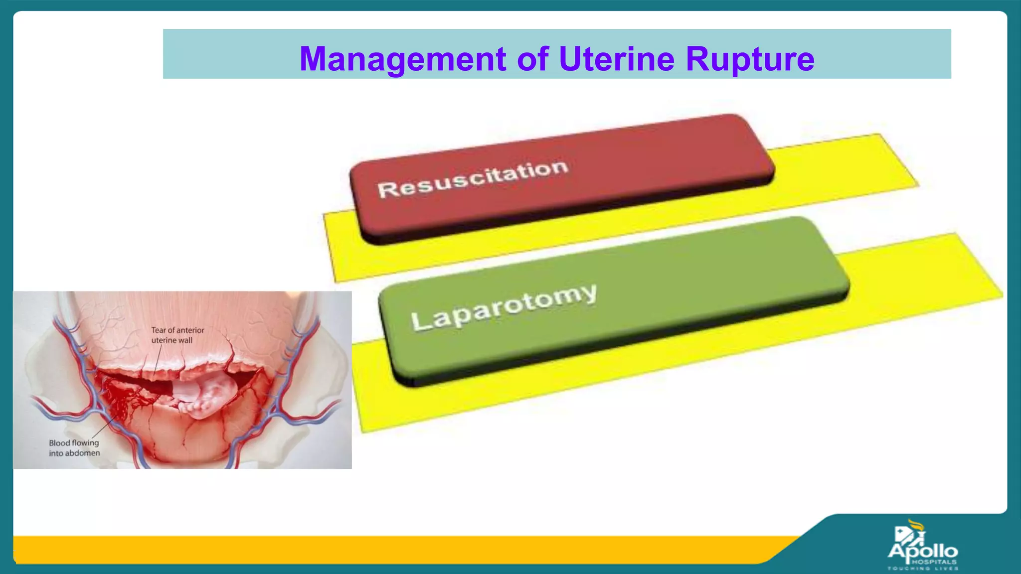 Obstetrical emergencies | PPTX