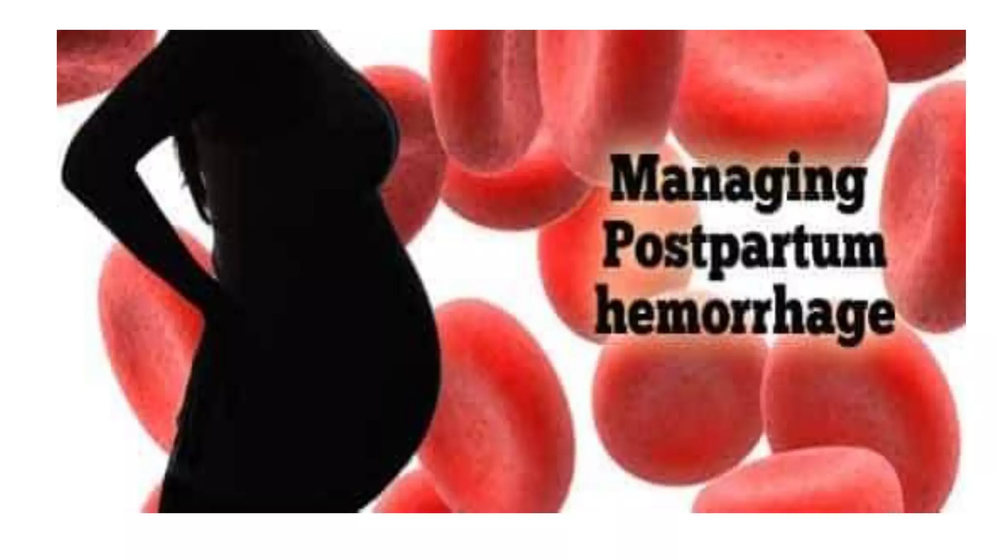 Obstetrical emergency & nsg management | PPT