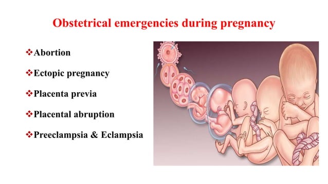 Obstetrical emergency & nsg management | PPT