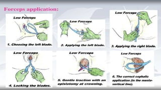 OBSTETRICAL OPERATIONS & PROCEDURES.pptx