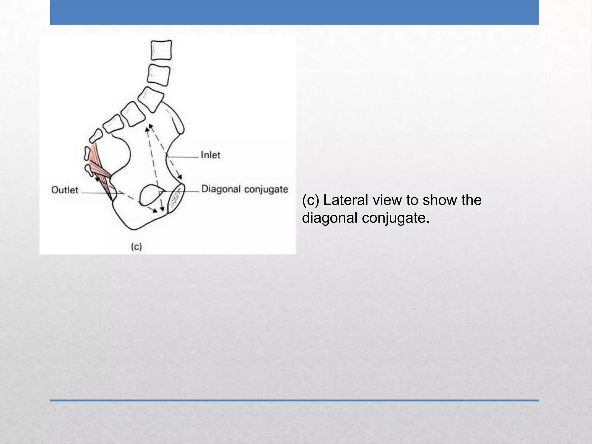 Obstetrical pelvic measurements | PPTX