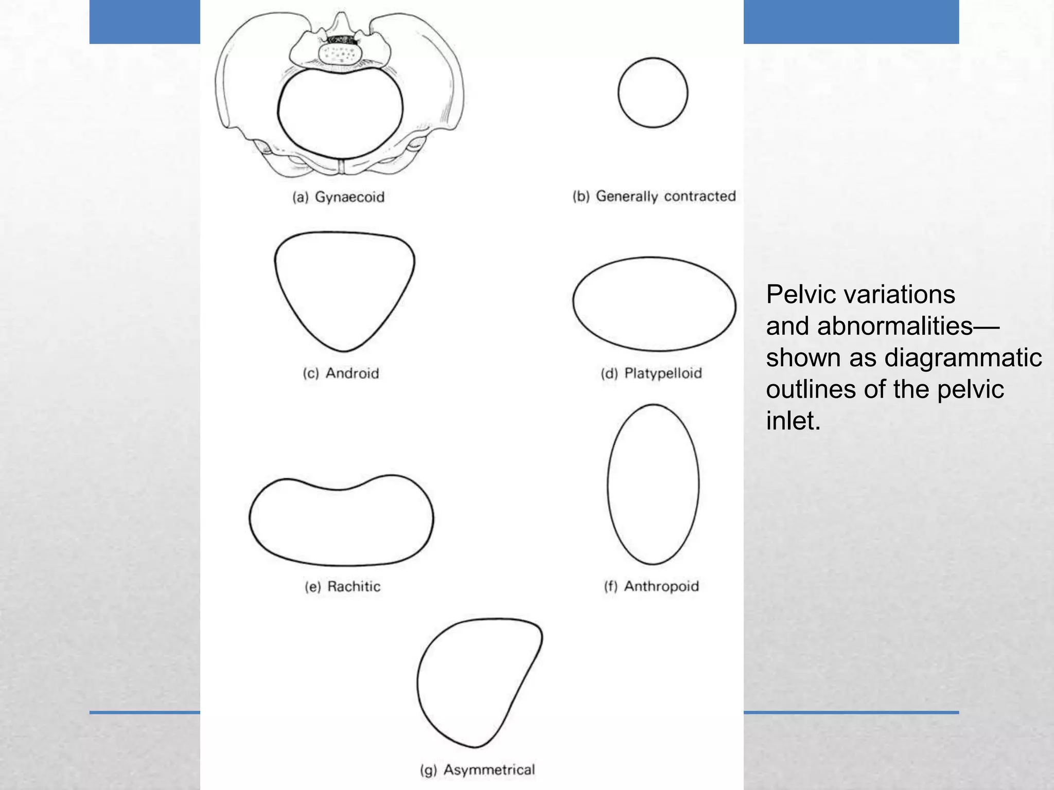 Obstetrical pelvic measurements | PPTX