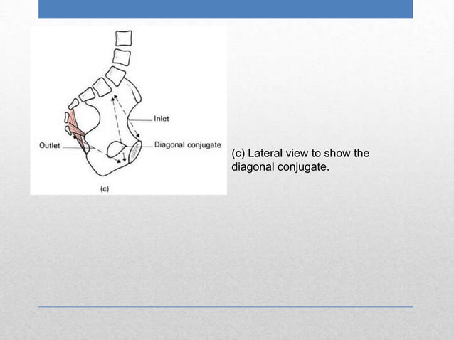 Obstetrical pelvic measurements | PPTX | Pregnancy | Reproductive Health