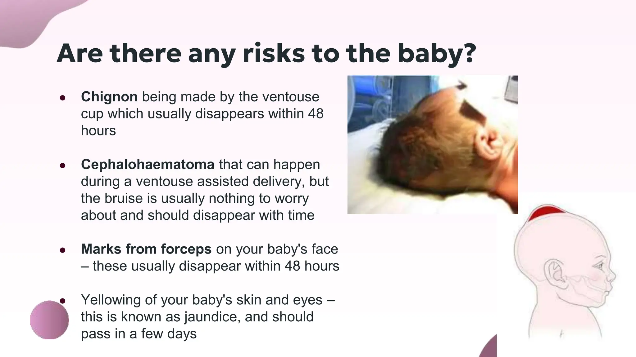 Obstetrical Surgeries - Operative vaginal deliveries are accomplished ...