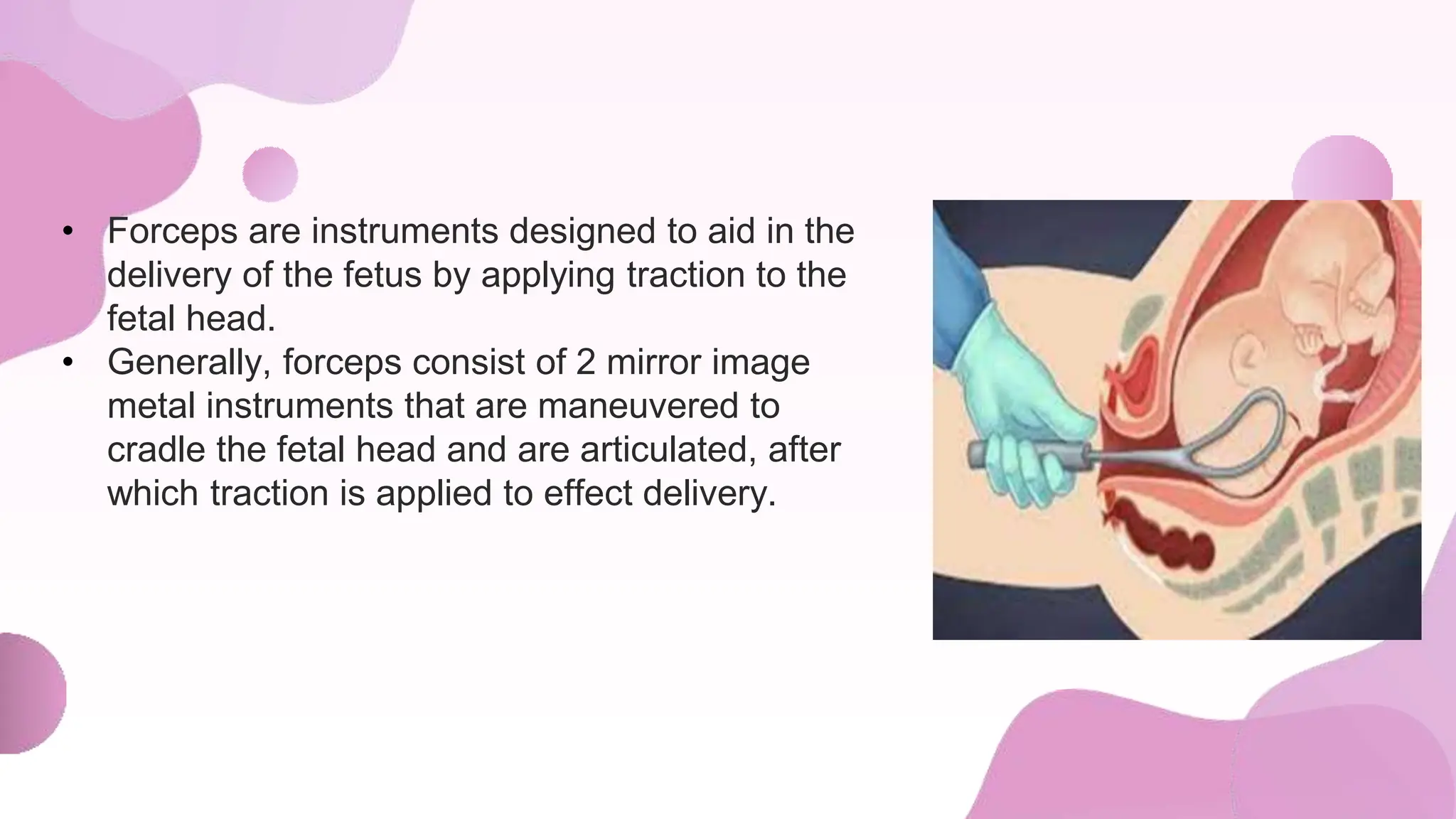 Obstetrical Surgeries - Operative vaginal deliveries are accomplished by applying direct ...