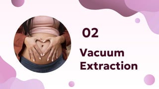 Obstetrical Surgeries - Operative vaginal deliveries are accomplished by applying direct ...