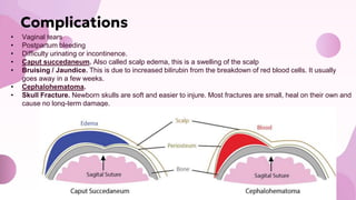 Obstetrical Surgeries - Operative vaginal deliveries are accomplished ...