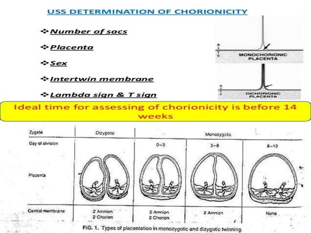 DEB MDRD Obstetrical ultrasound 1ST TRIMESTER | PPT
