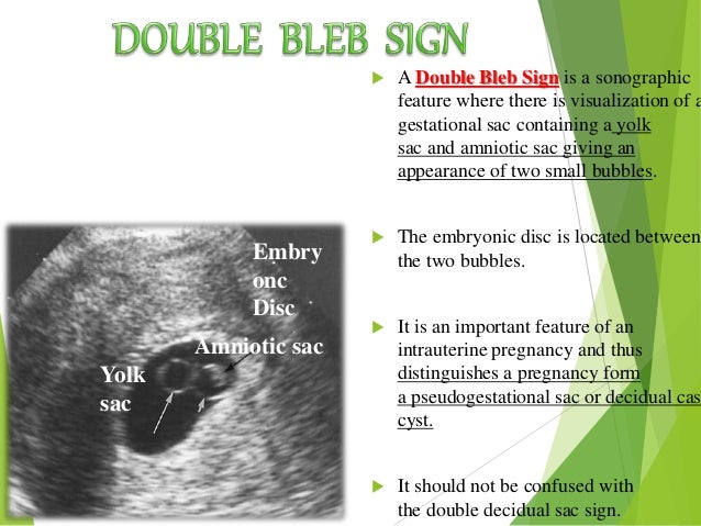 DEB MDRD Obstetrical ultrasound 1ST TRIMESTER