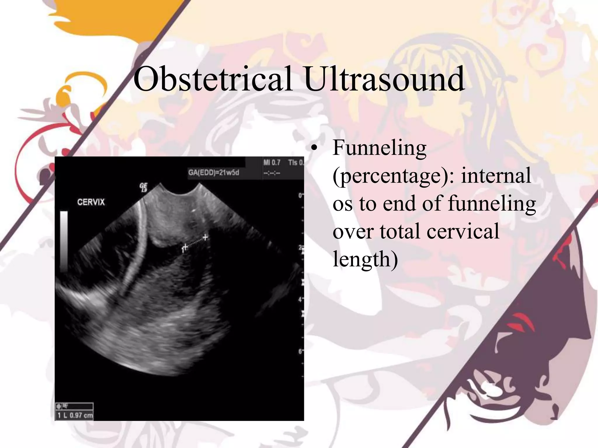 Obstetrical Ultrasound | PPTX