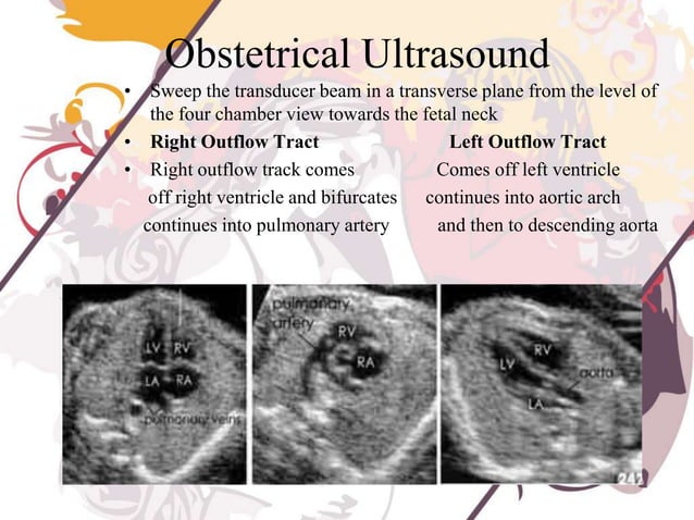 Obstetrical Ultrasound