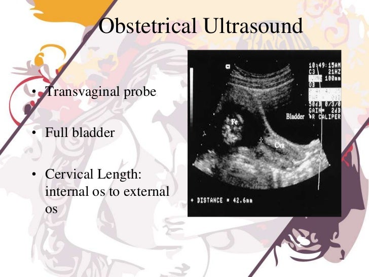 Obstetrical Ultrasound