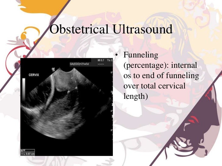 Obstetrical Ultrasound
