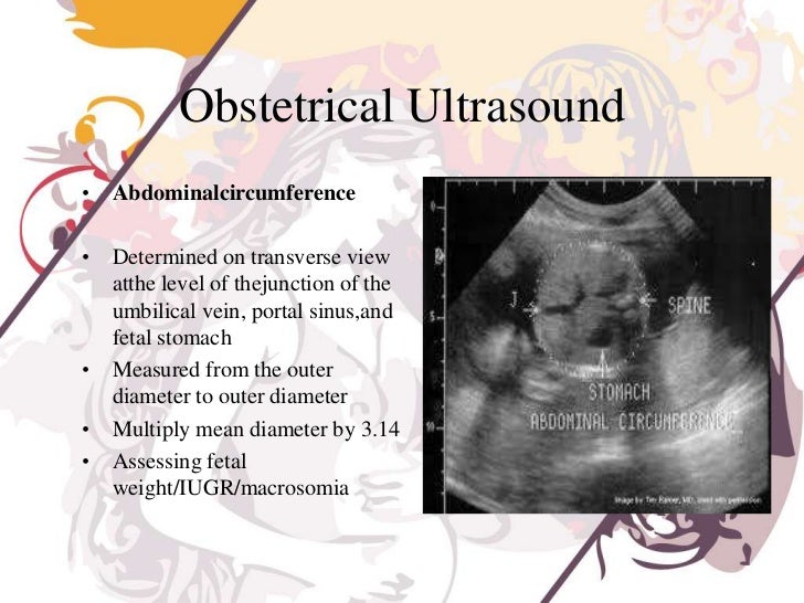 Obstetrical Ultrasound