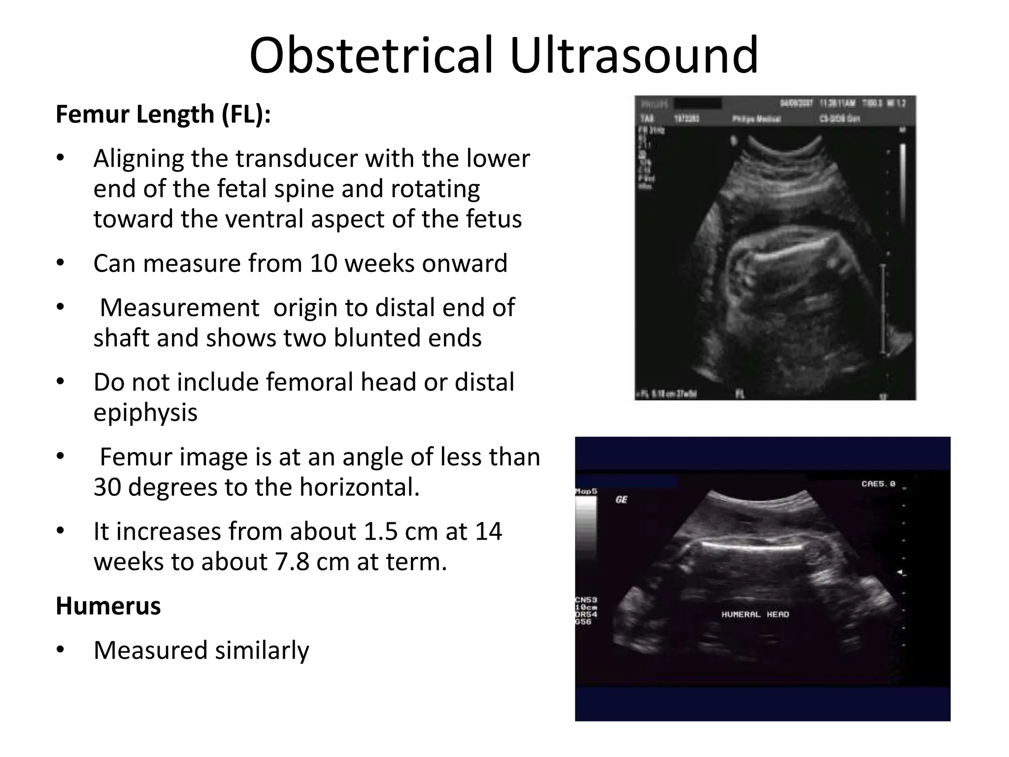details of the Obstetrical Ultrasound.pptx