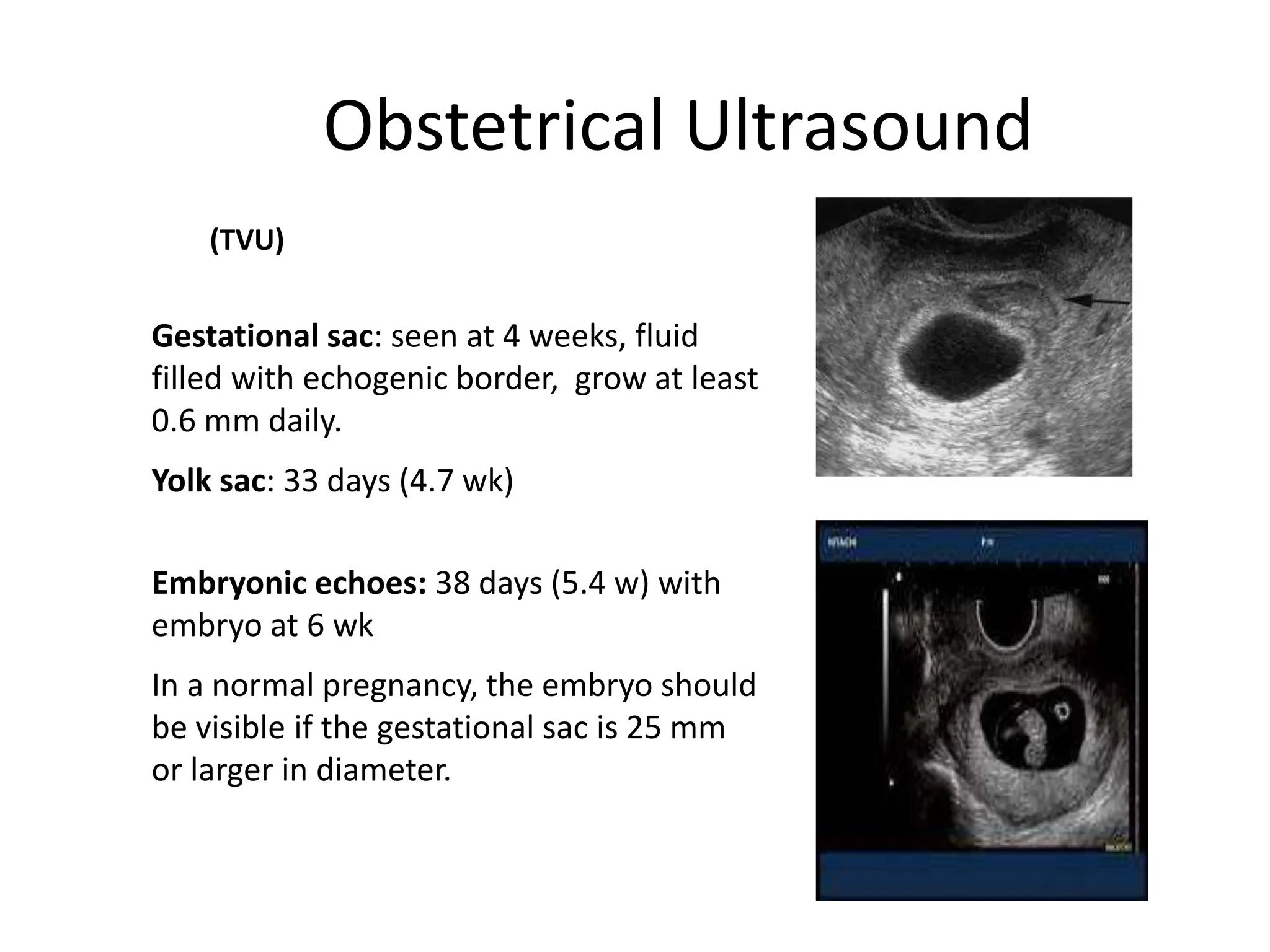 details of the Obstetrical Ultrasound.pptx