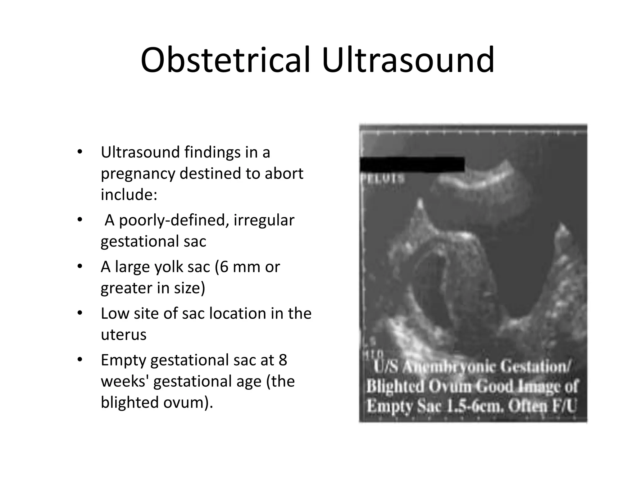 details of the Obstetrical Ultrasound.pptx