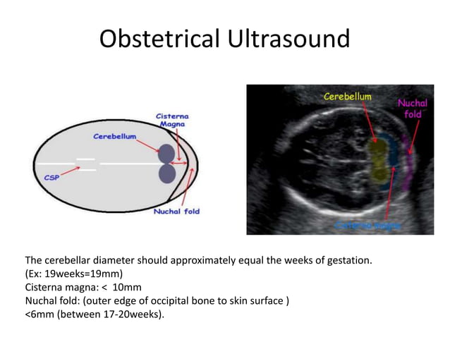 details of the Obstetrical Ultrasound.pptx