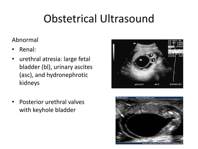 details of the Obstetrical Ultrasound.pptx
