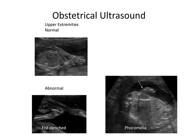details of the Obstetrical Ultrasound.pptx