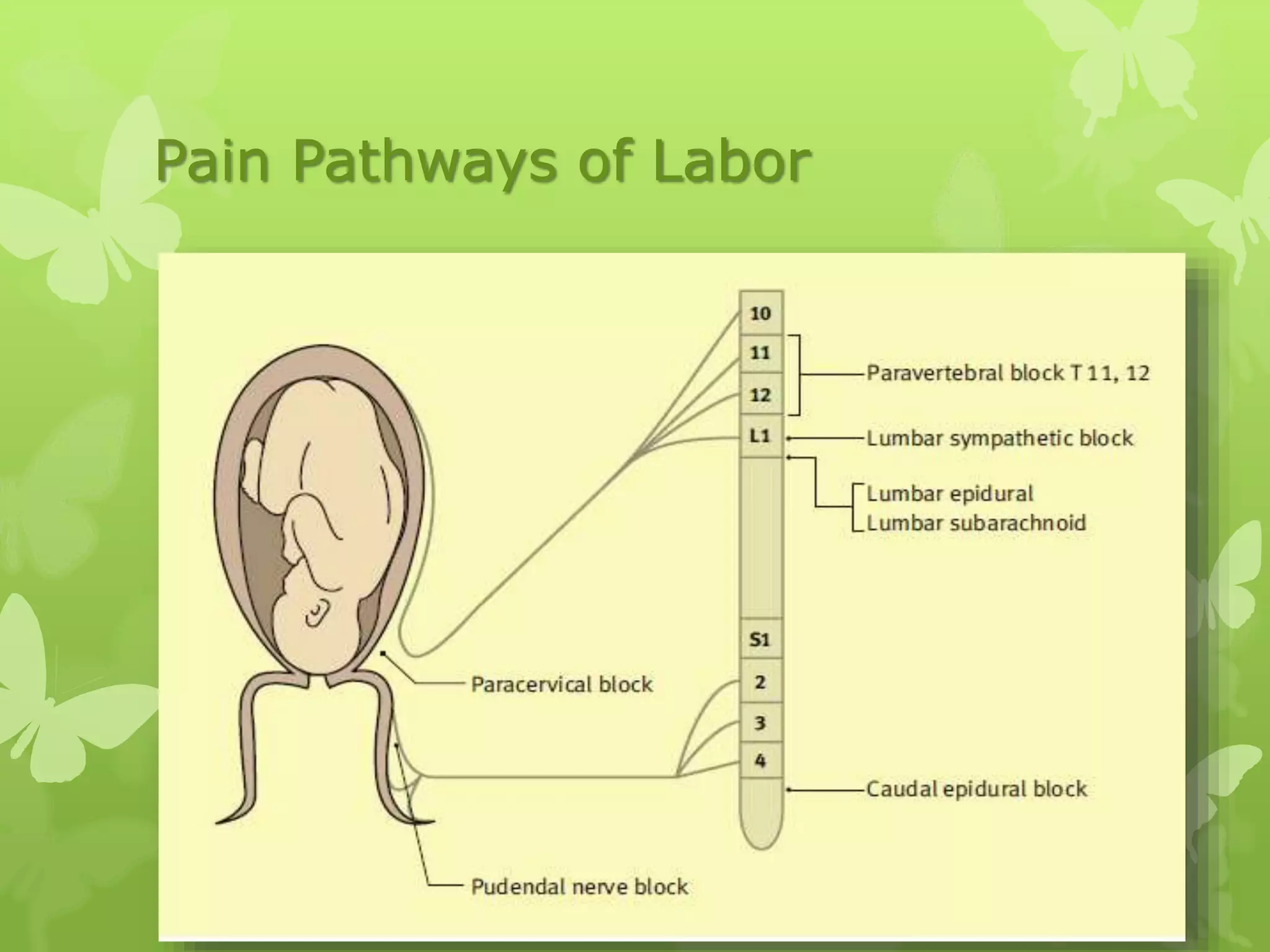 Obstetric anaesthesia and analgesia | PPTX
