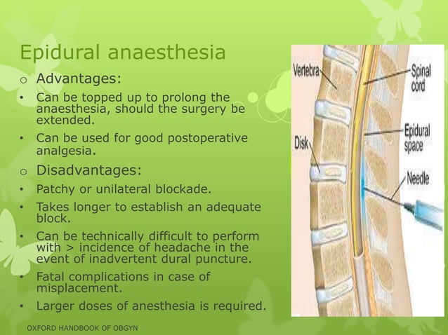 Obstetric anaesthesia and analgesia | PPTX