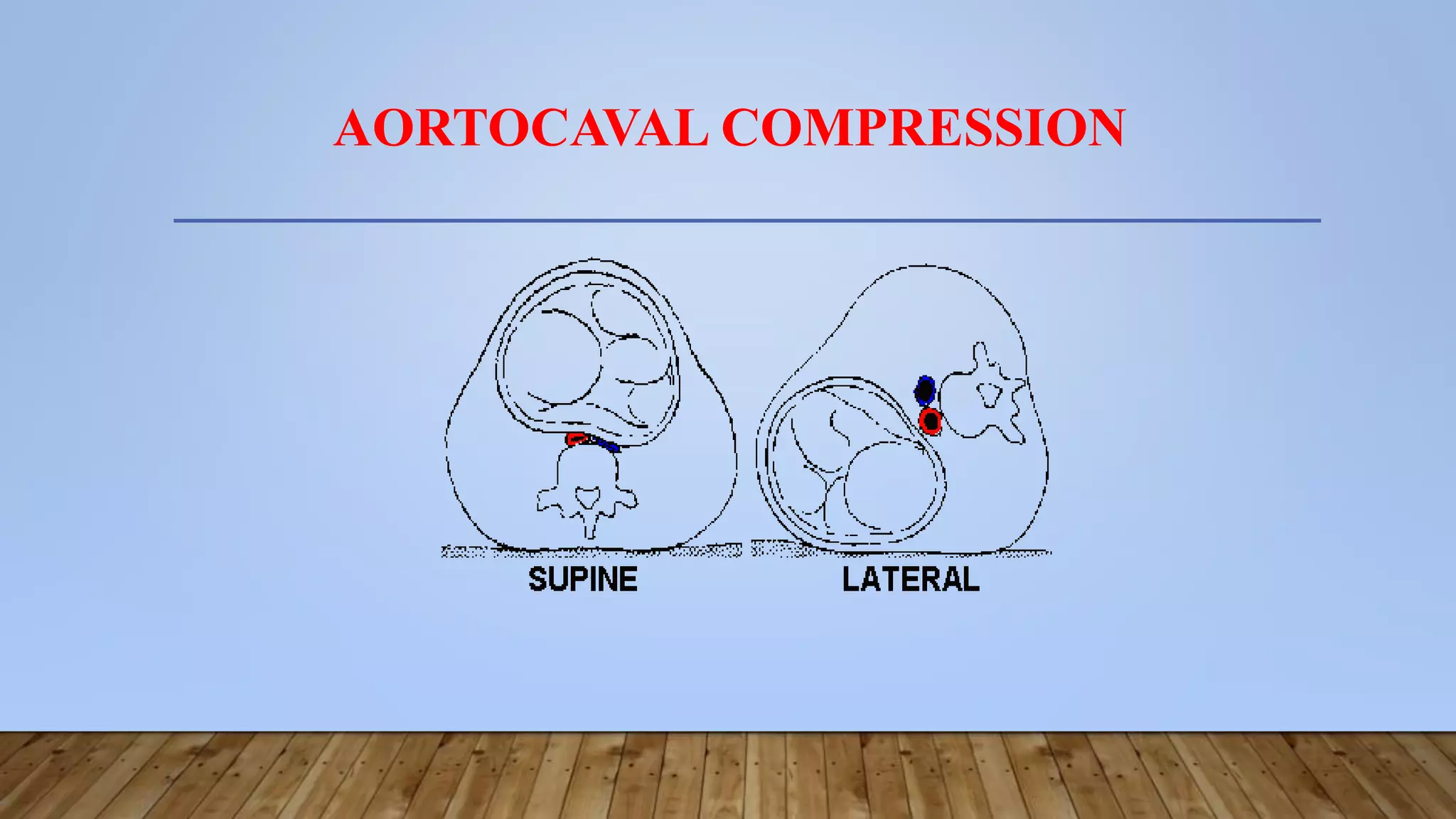 obstetric anesthesia.pptx